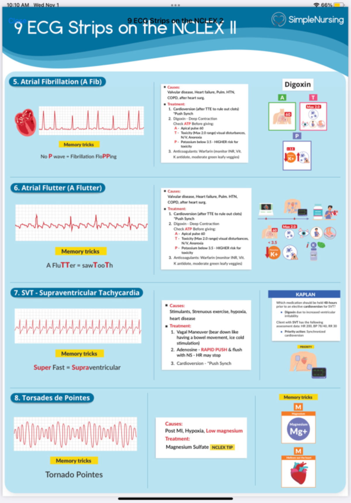 EKG Strips 2 - EKG interpretation - 10:10 AM Wed Nov 1 Close 9 ECG ...