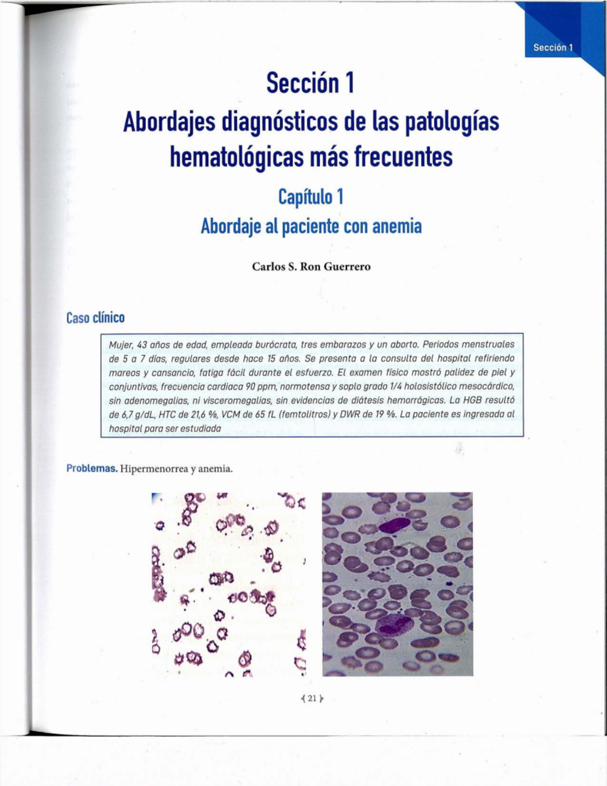 Abordaje Clínico del Paciente con Anemia - Caso 1 (Hematología) - Studocu