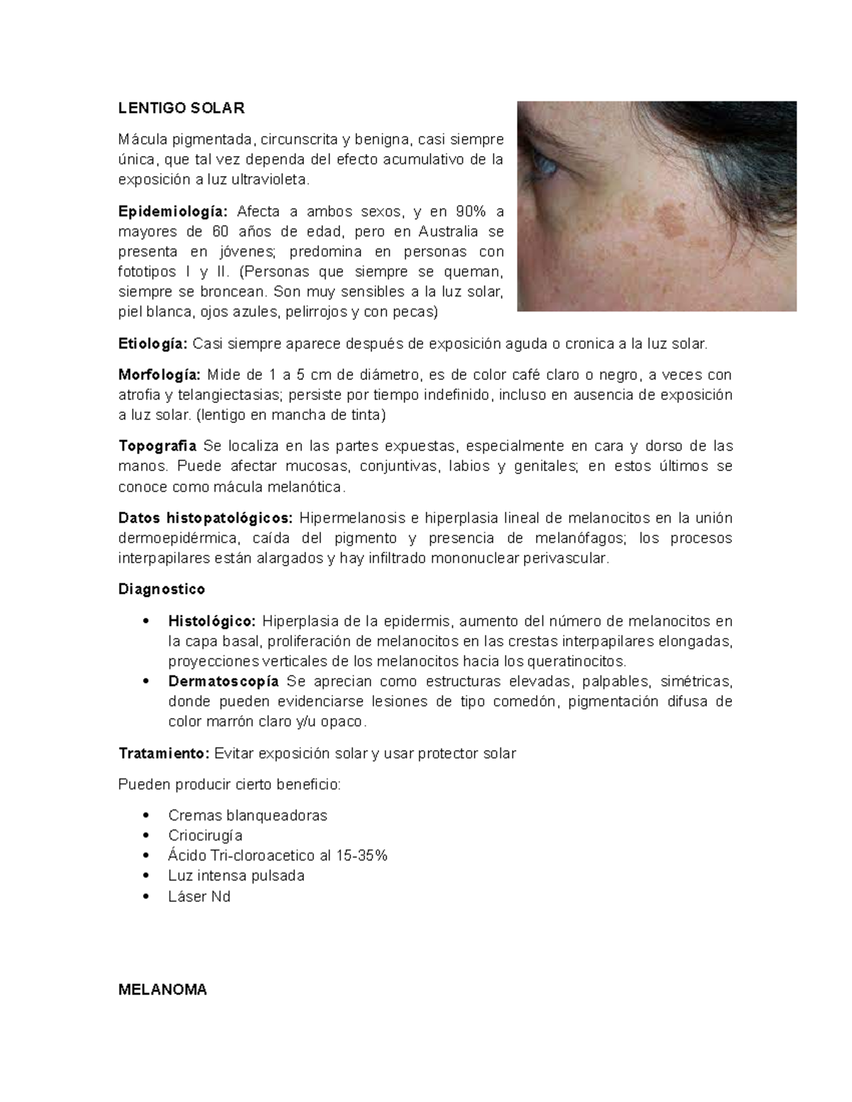 Melanoma y lentigo solar - LENTIGO SOLAR Mácula pigmentada ...