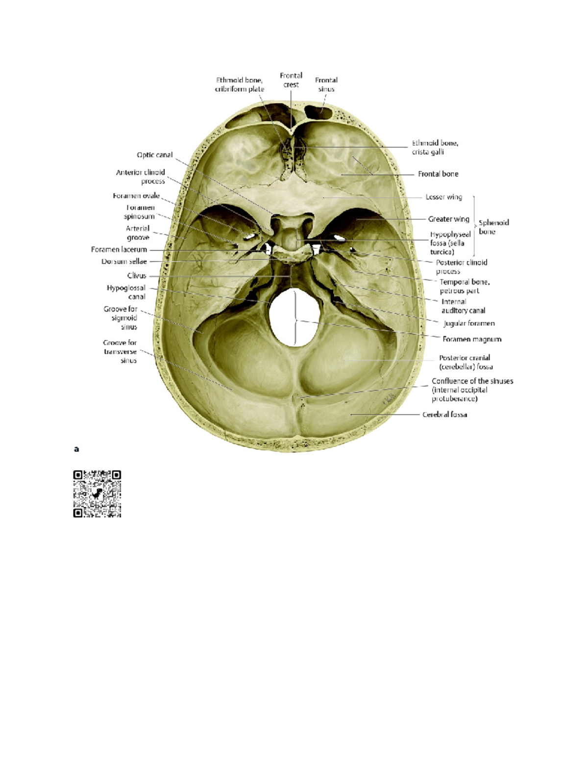 Cranial Nerves and Skull Base Anatomy: A Comprehensive Overview (16.1 ...