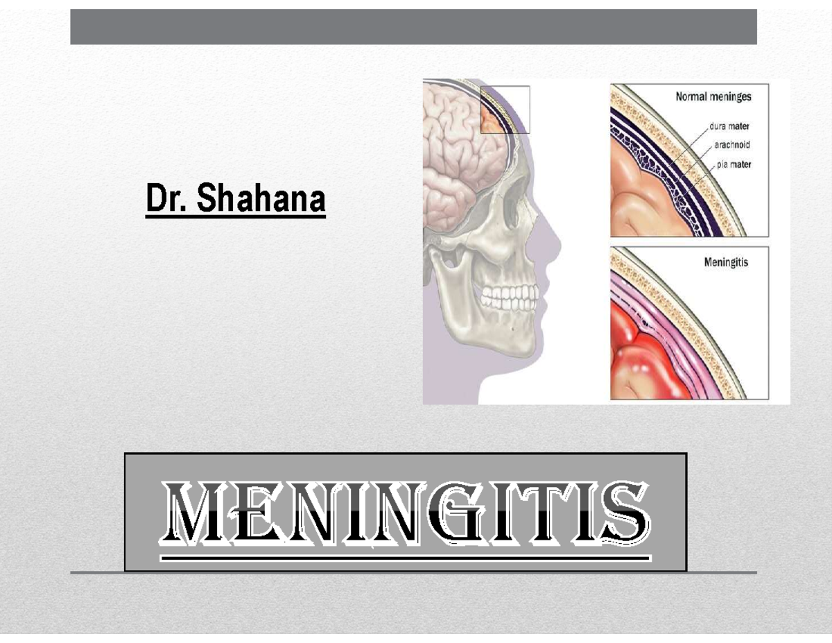 Case Study: Meningitis Overview and Treatment Notes - Studocu