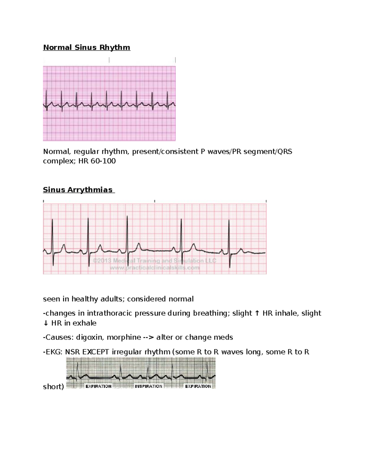 EKG Rhythm and Medications Overview for Cardiac Care (NUR 101) - Studocu