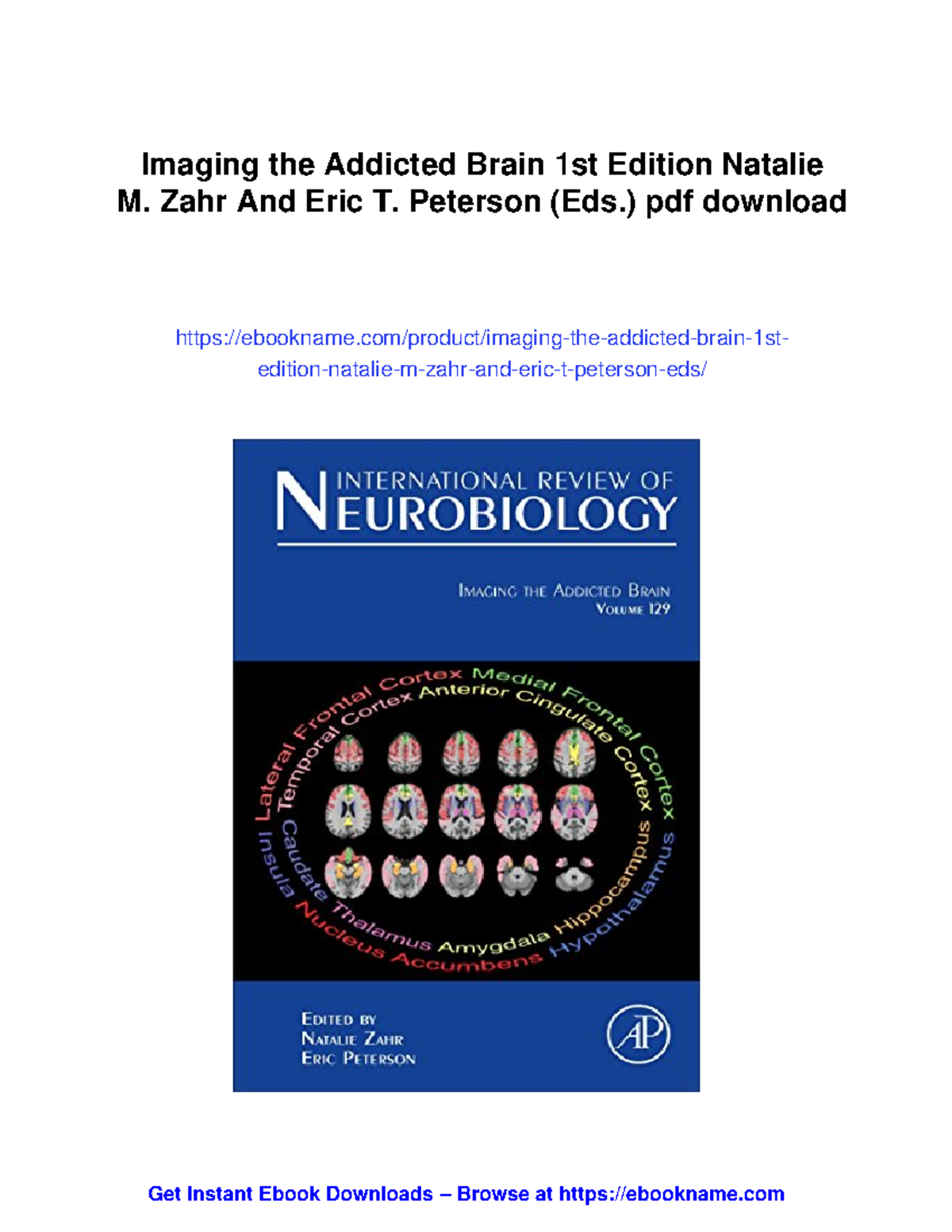 Imaging the Addicted Brain: Insights from Neurobiology and MRI ...