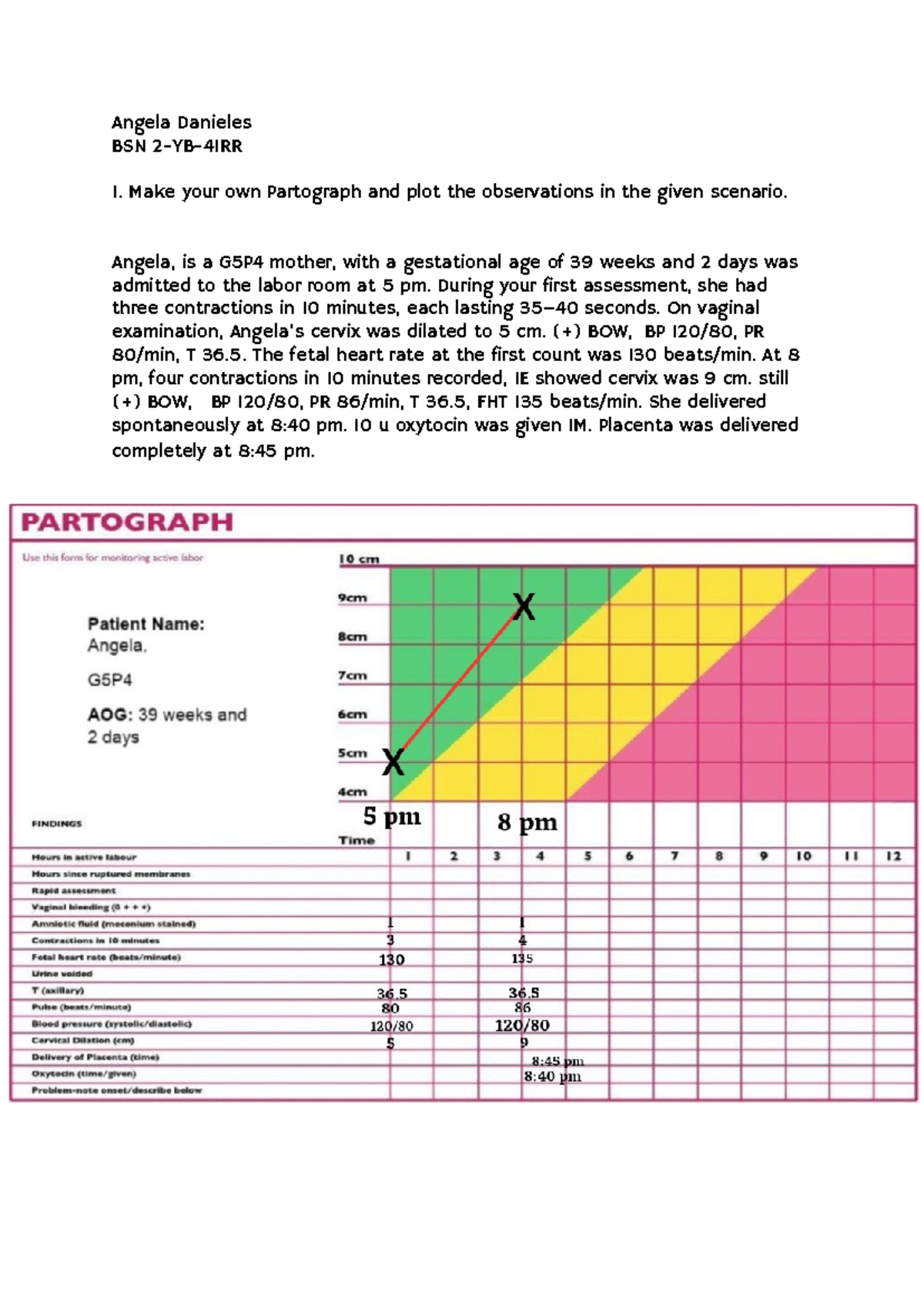 BSN 2-YB-4IRR Partograph Analysis for G5P4 Mother Case Study - Studocu