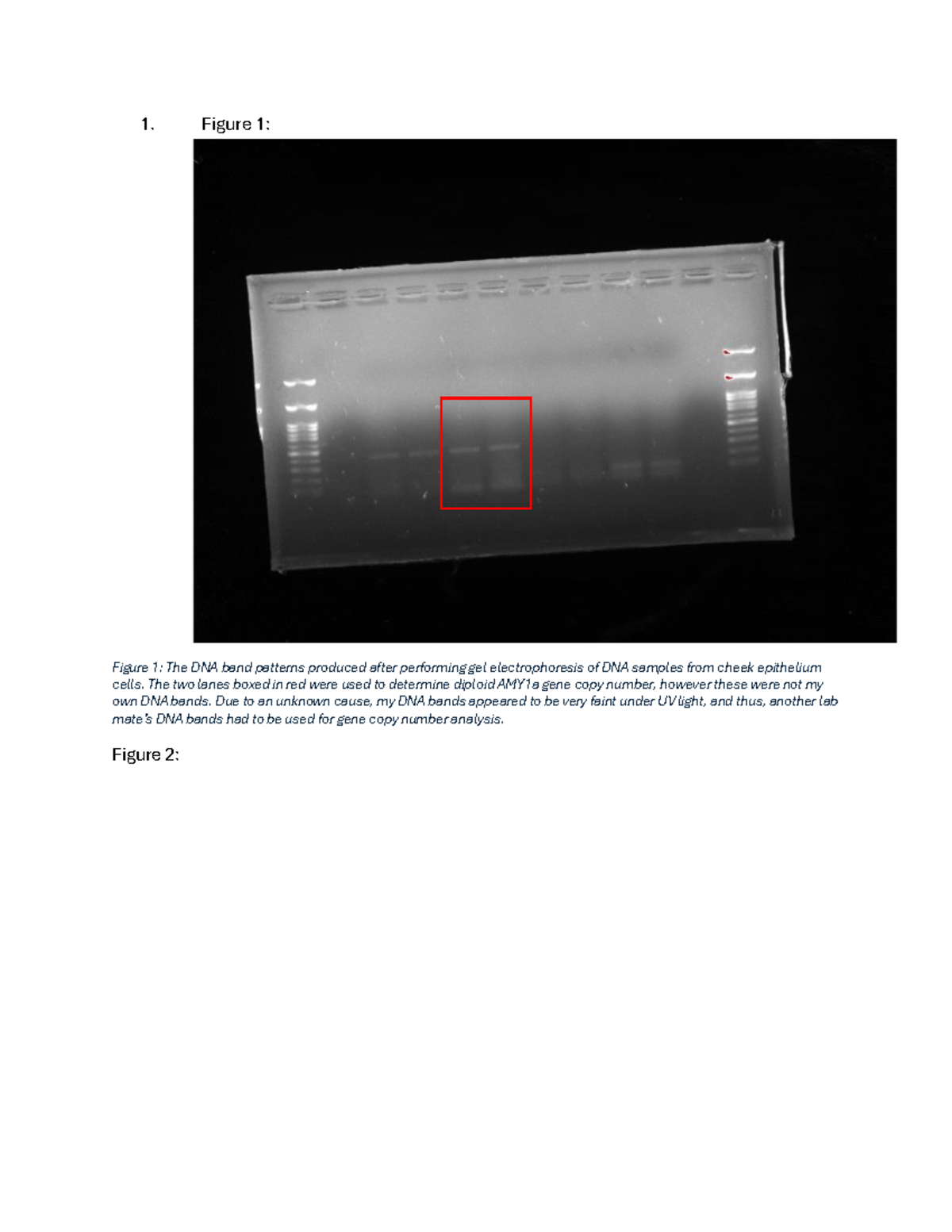 BIO 1A03 - Post Lab 4: DNA Band Patterns & AMY1a Gene Analysis - Studocu