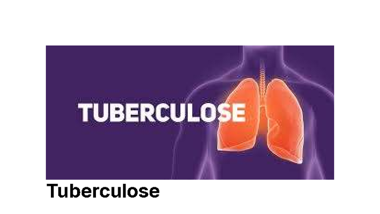 Tuberculose: Diagnóstico, Tratamento e Transmissão - KKKK - Studocu