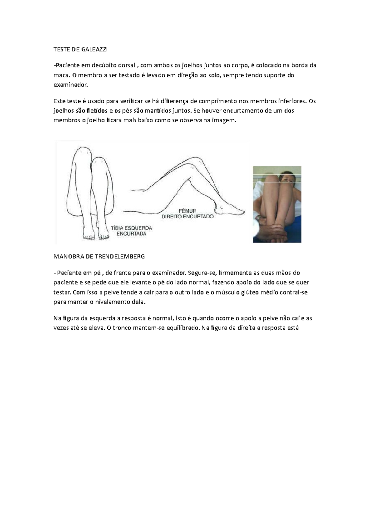 Teste ortopedico- todos os testes ortopedicos - TESTE DE GALEAZZI ...