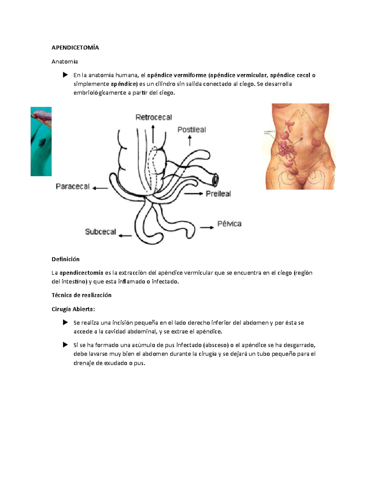 Apendicetomia - APENDICETOMÍA Anatomía En la anatomía humana, el ...