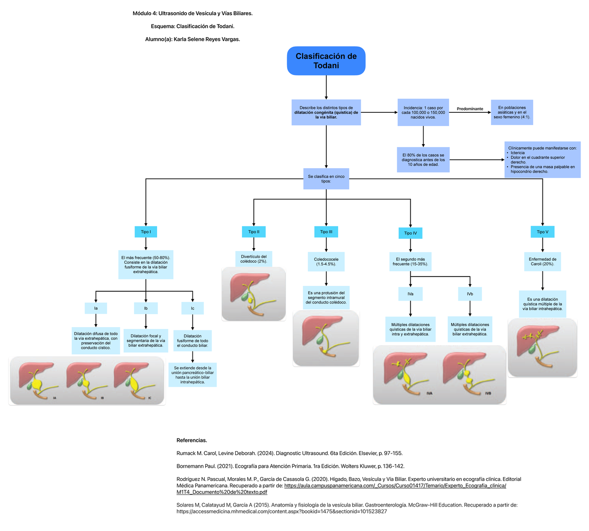 Esquema: Clasifiación de Todani - Módulo 4: Ultrasonido de Vesícula y ...