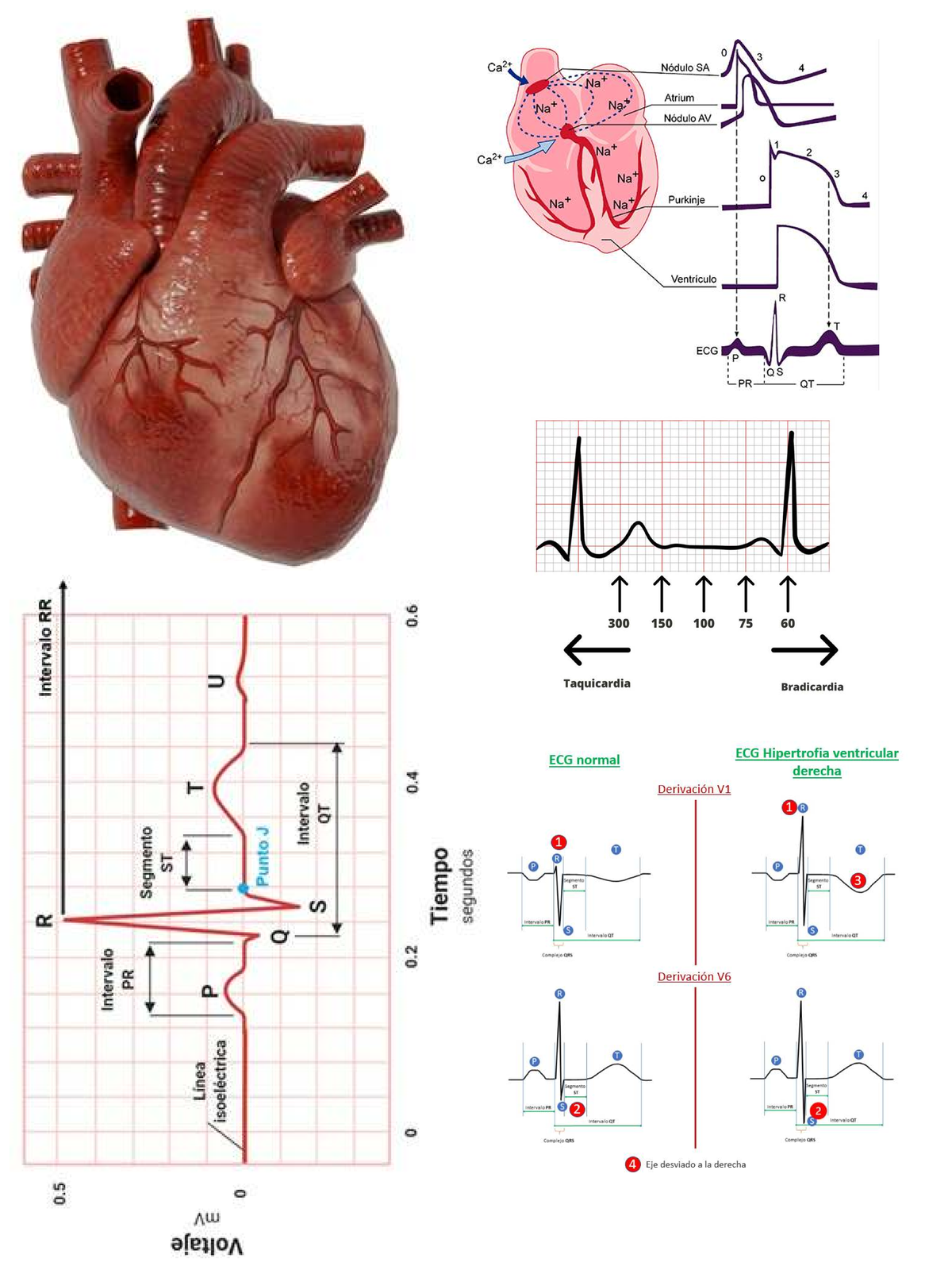 ECG Analysis: Nódulo SA, Nódulo AV, and Interval Measurements - Studocu
