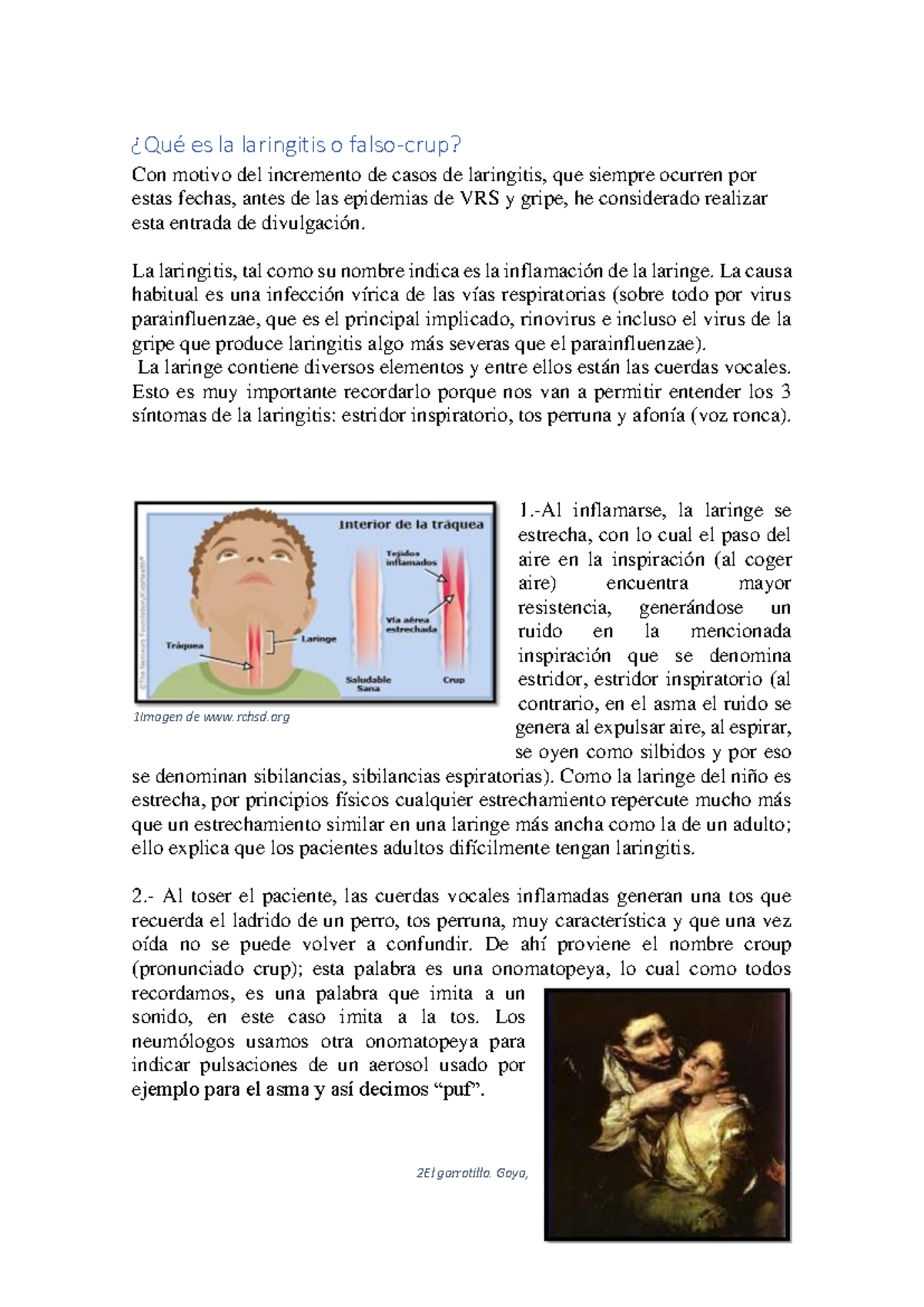 Laringitis o falso crup - ¿Qué es la laringitis o falso-crup? Con ...