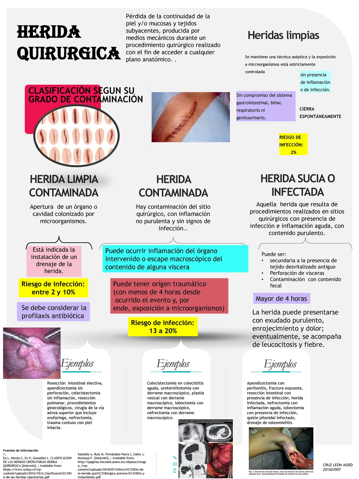Suturas X y Z: Técnica y Tiempo de Aplicación en Urgencias - Studocu