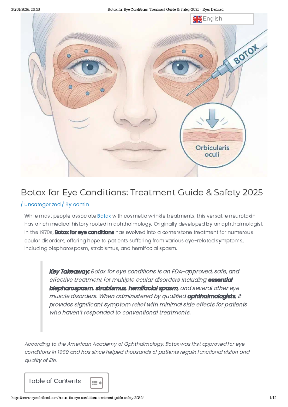 23:30 Botox for Eye Conditions: Comprehensive Treatment & Safety Guide ...
