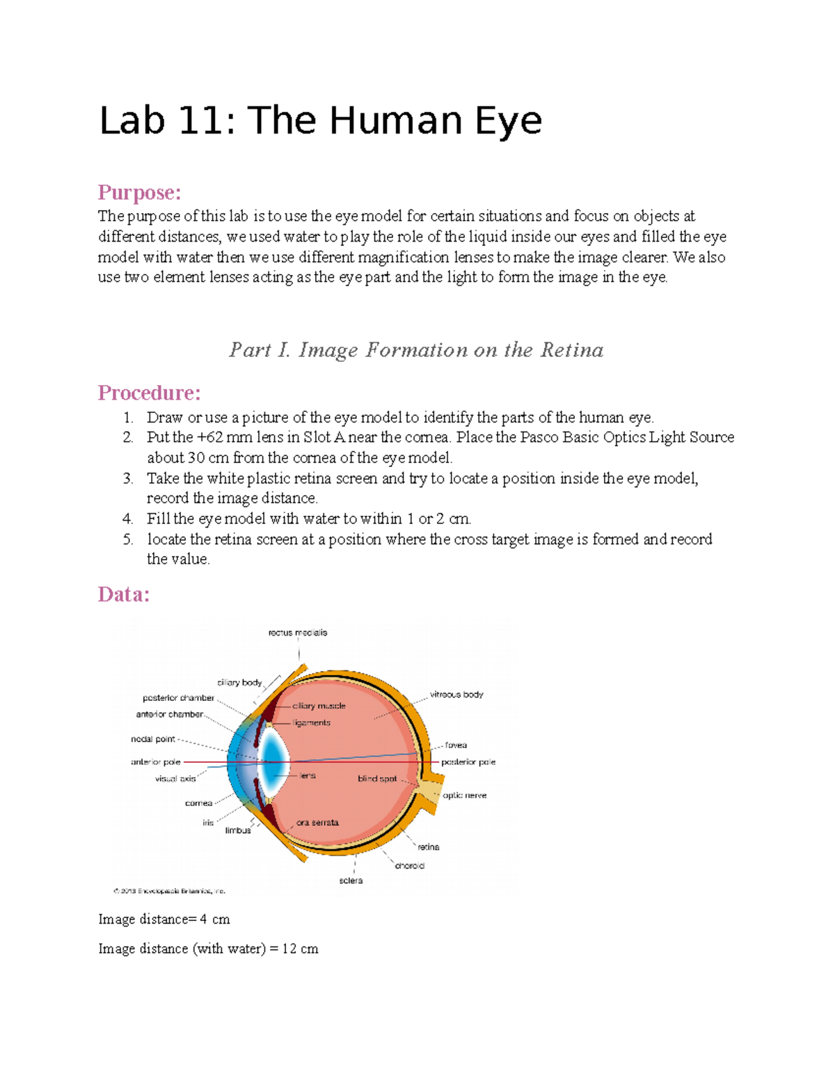 Lab 11 - Human Eye: Image Formation & Accommodation Report - Studocu