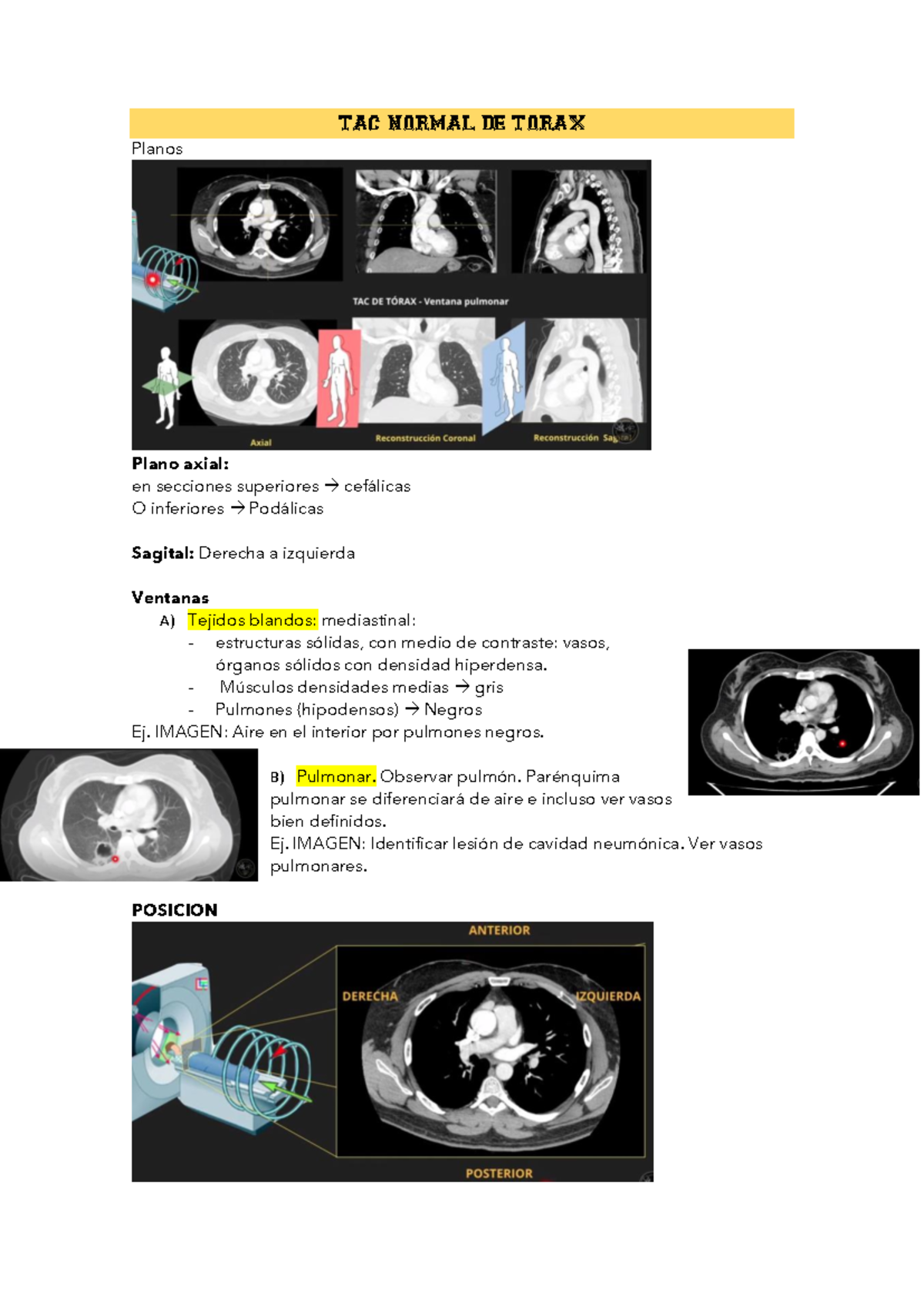 TAC Normal DE Torax - Bueno - TAC NORMAL DE TORAX Planos Plano axial ...