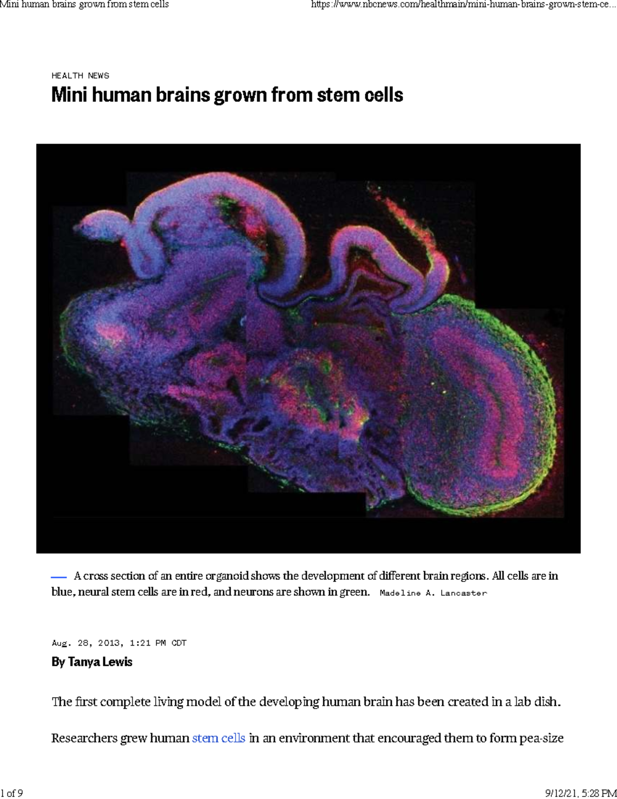 Cerebral Organoids: Advancements in Stem Cell Research and Brain ...