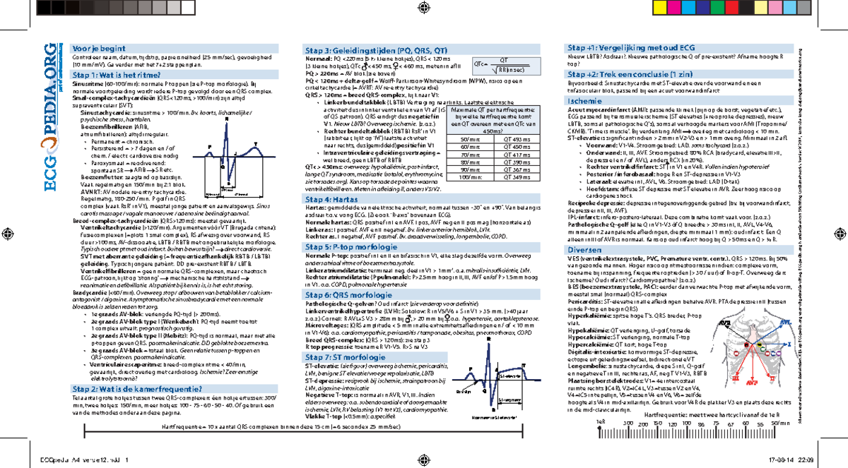 ECGpedia Zakkaartje - zakkaart ECG - Voor je begint Controleer naam ...