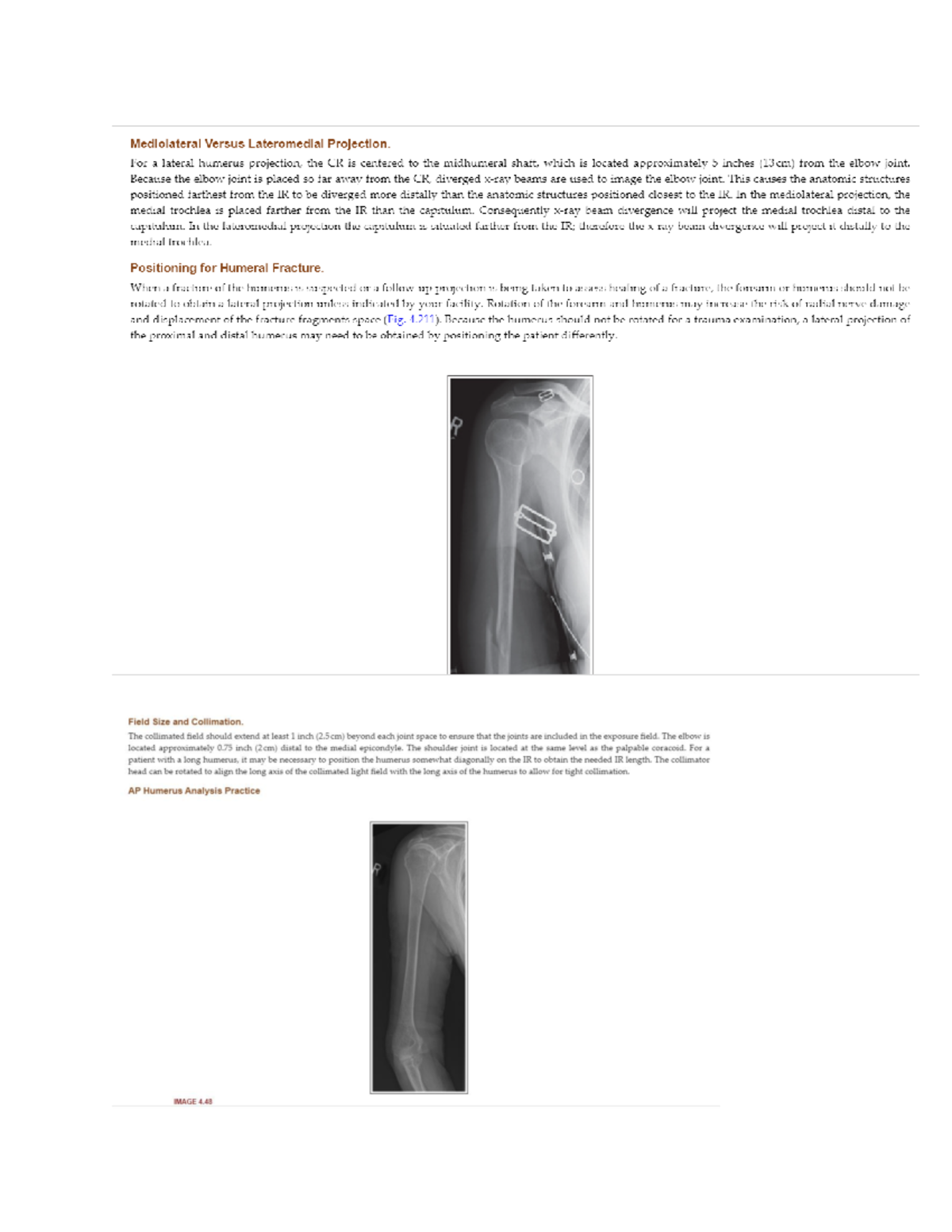 Humerus Imaging Techniques: Mediolateral & Lateromedial Projections ...