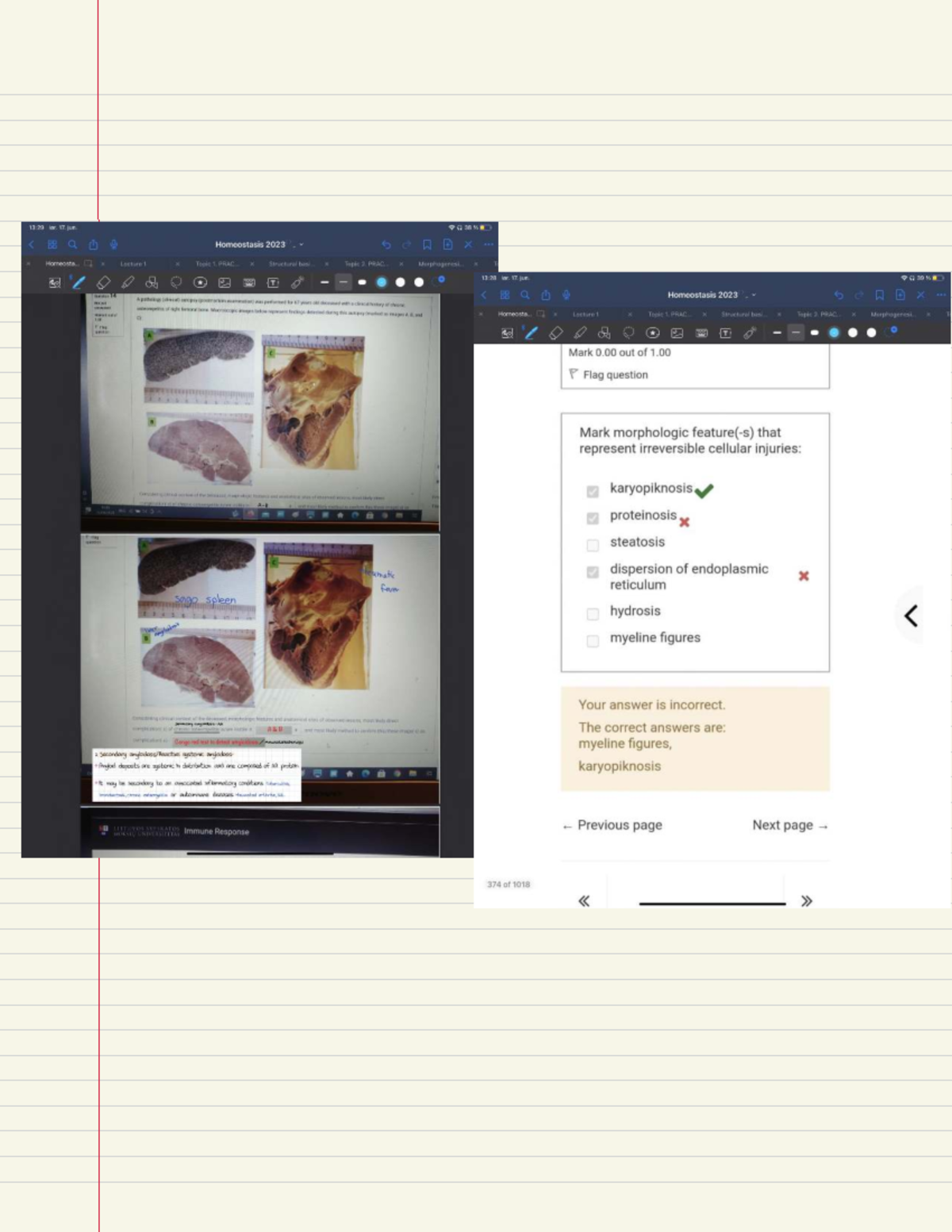 PATH 2023: Homeostasis Lecture Notes and Pathology Insights - Studocu