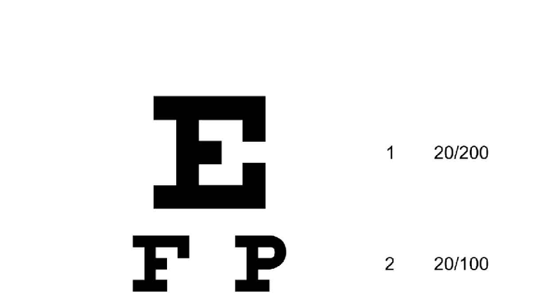 Snellenchart en - materials - health assessment - 1 20/200 P 2 20100 o ...