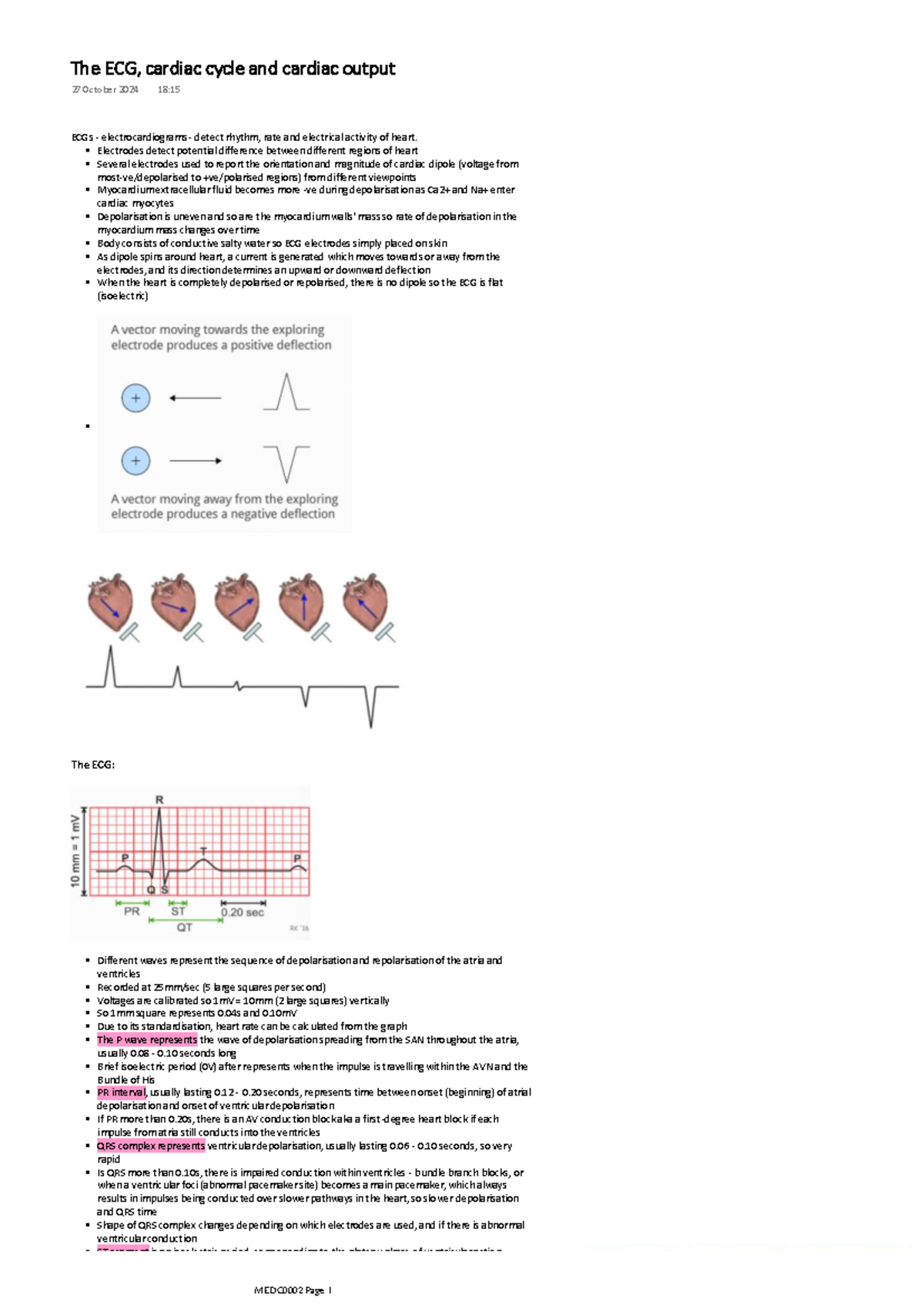 The ECG, cardiac cycle and cardiac output - ECGs - electrocardiograms ...