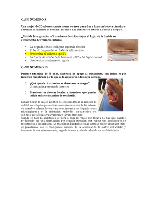 Patologia Necrosis, autolisis, heterolisis y muerte celular - PATOLOGÍA ...
