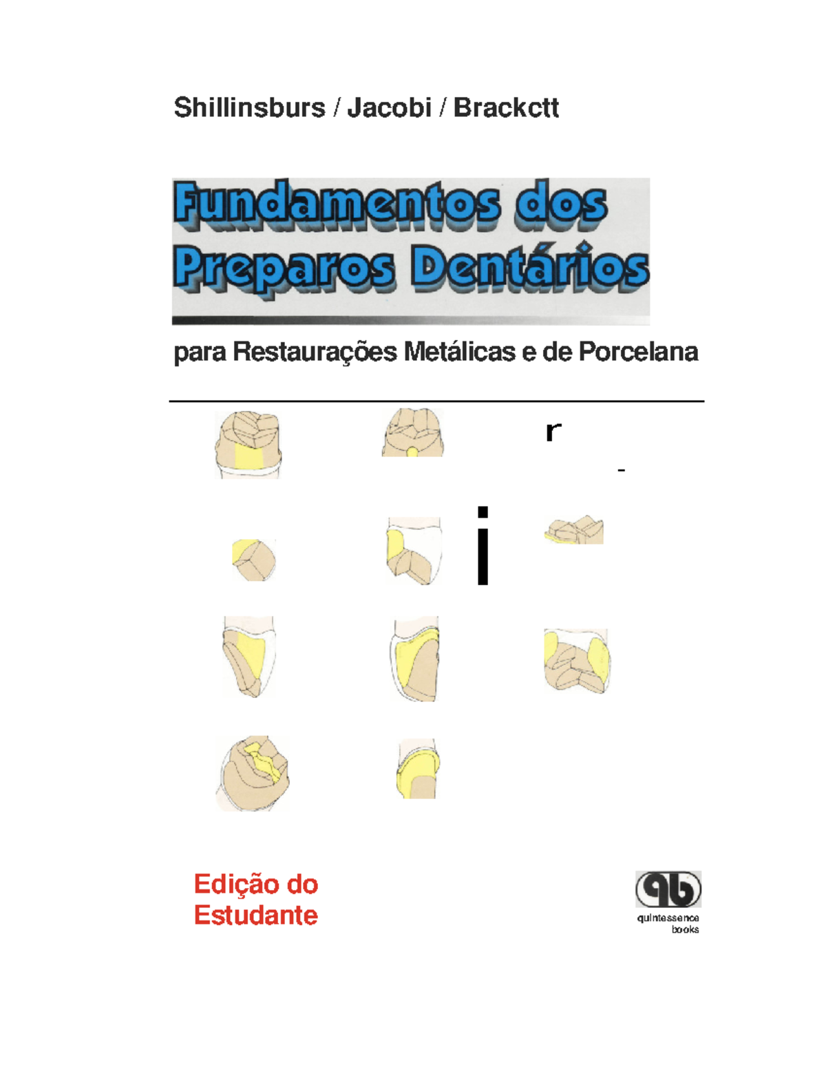 Fundamentos da Prótese Fixa - Shillingburg (Edição Estudante) - Studocu