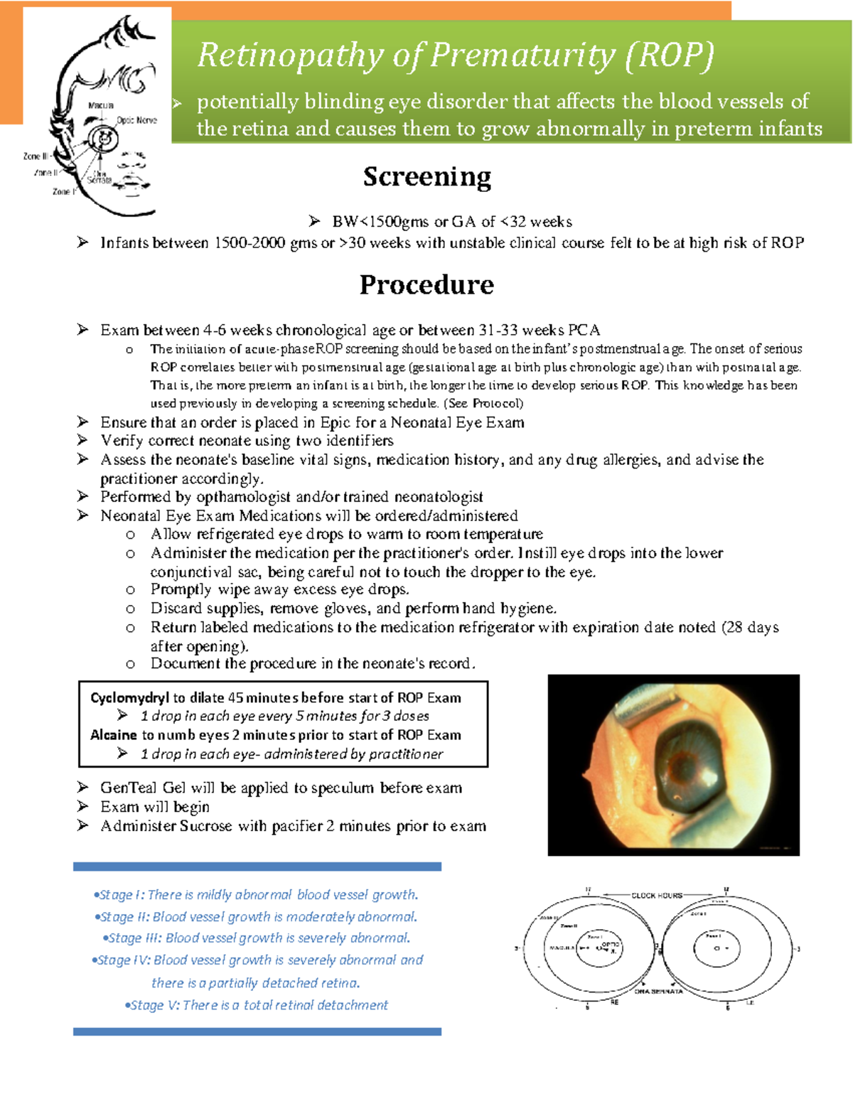 ROP Screening Protocol for Preterm Infants: Guidelines and Procedures ...