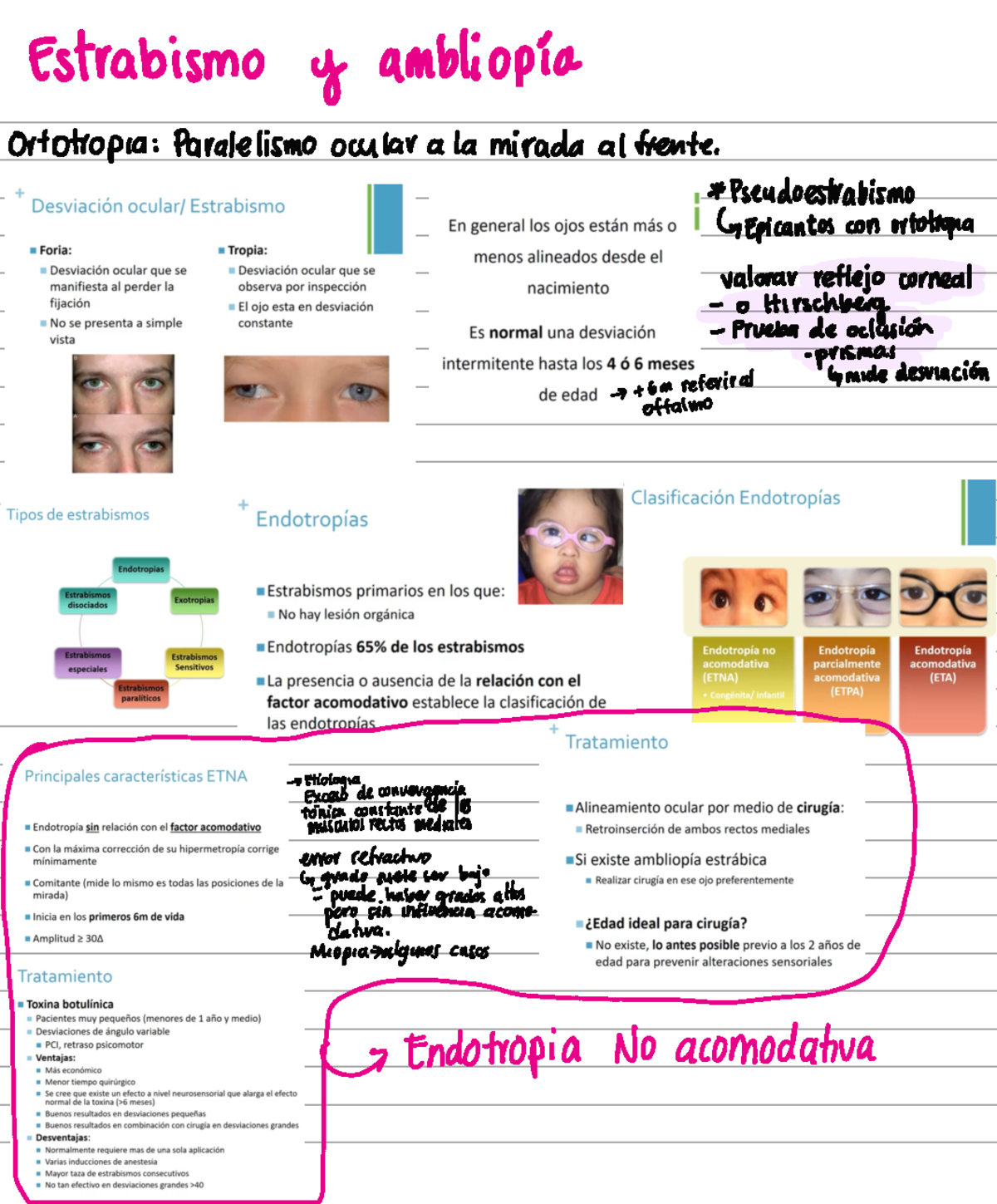 Estrabismo: ambliopía - Estrabismo y ambliopia Ortotropia: Paralelismo ...
