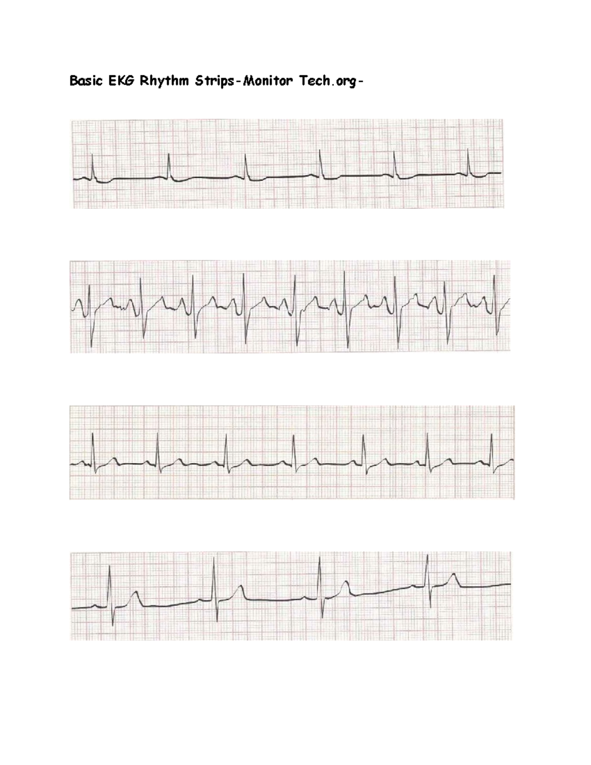 EKG Practice Strips - MS1 - Basic EKG Rhythm Strips-Monitor Tech- - Studocu