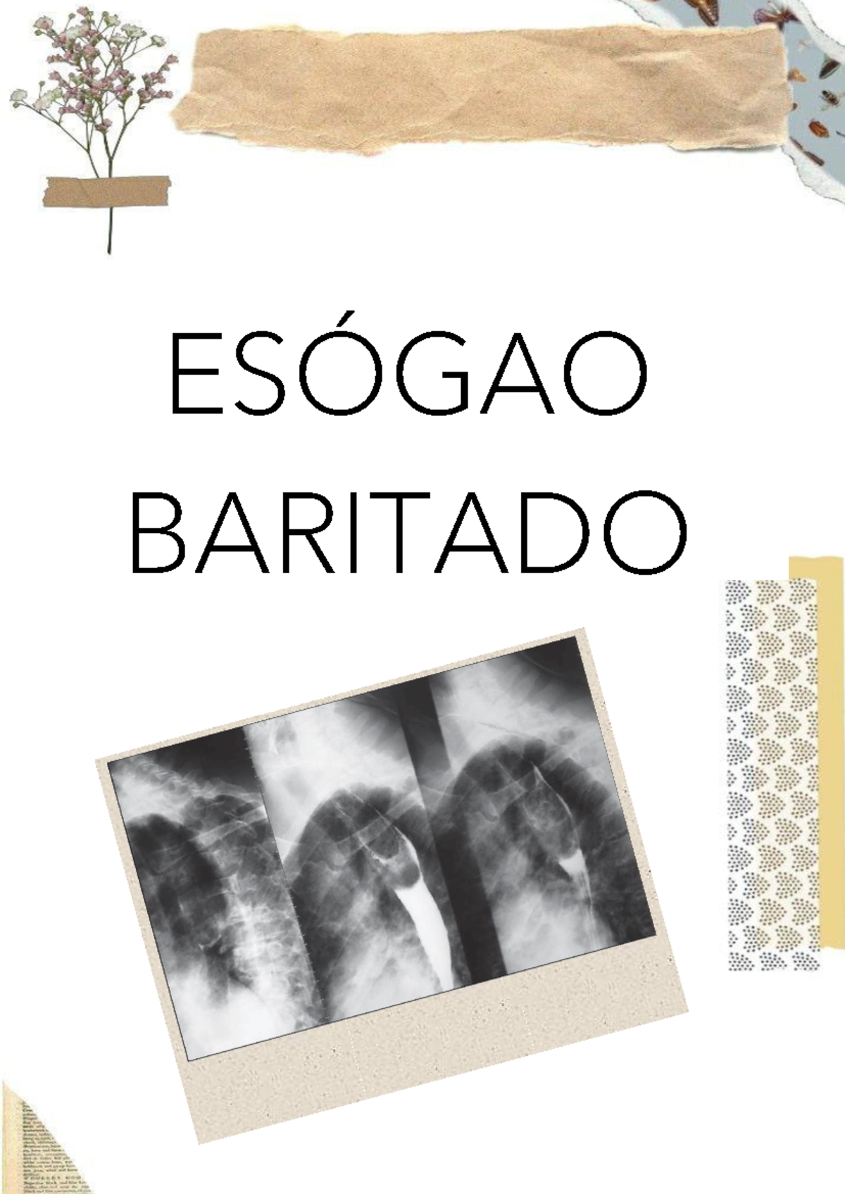 Esófago Baritado: Análisis y Protocolo en Imageniología (UCATECI) - Studocu