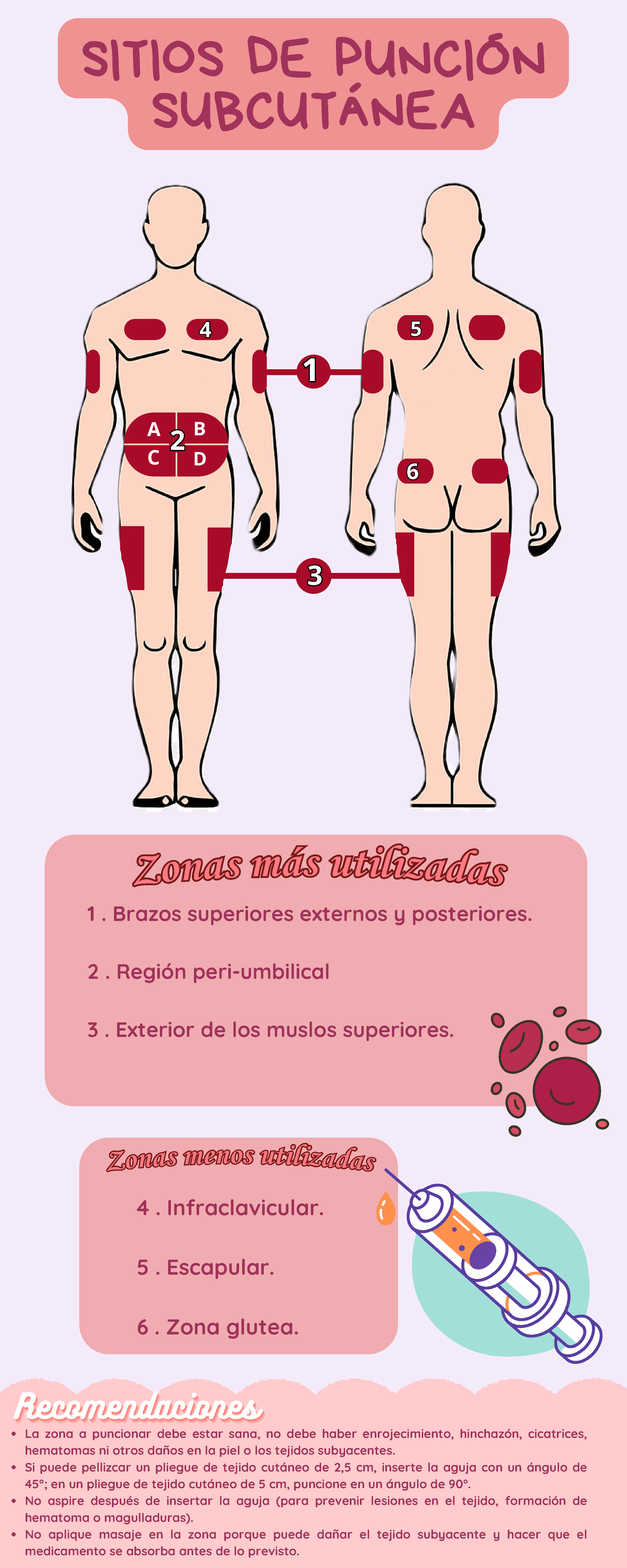 Infografía sobre Sitios de Punción Subcutánea SC - Studocu
