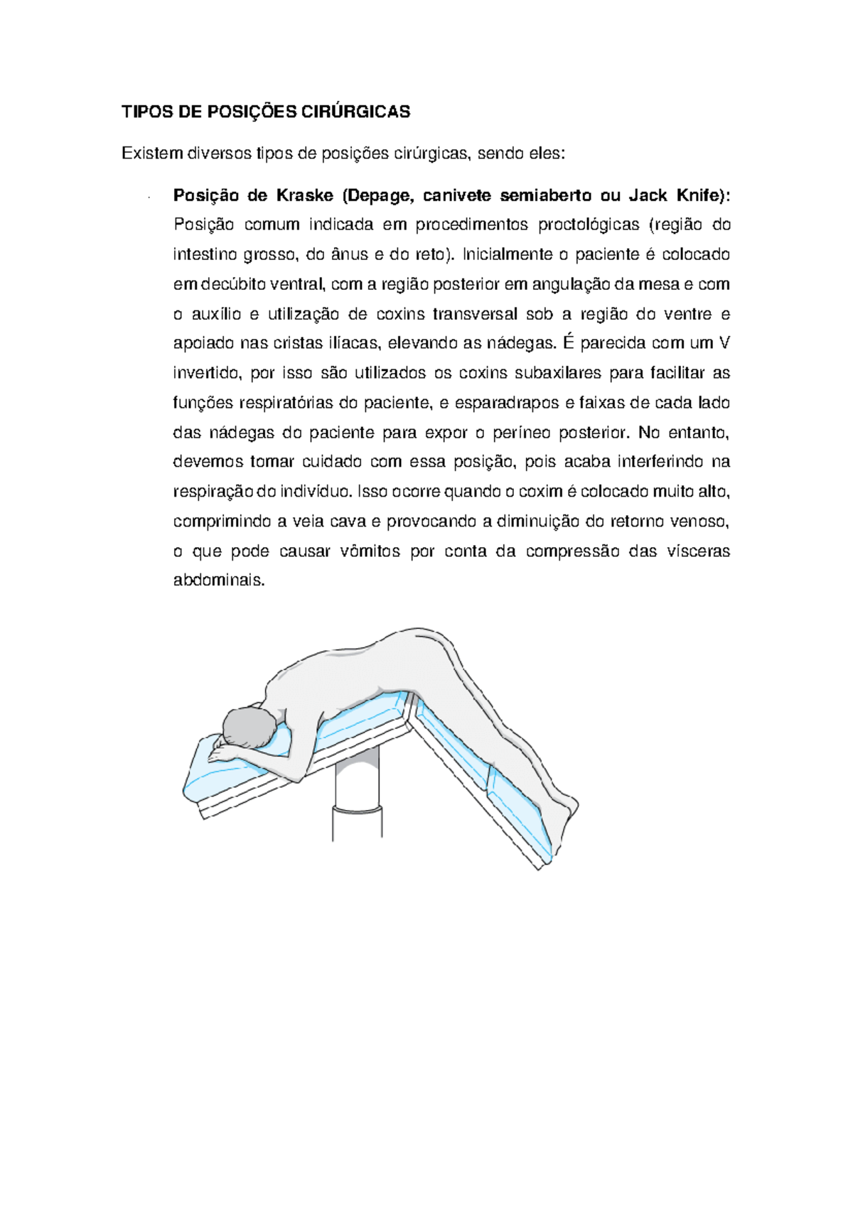 Tipos de Posições Cirúrgicas: Posição de Kraske em Centro Cirúrgico ...