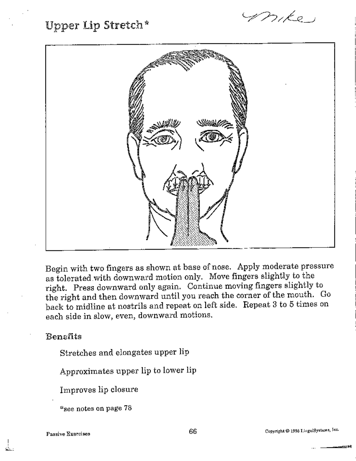 Bells Palsy - Facial Exercises and Techniques for Rehabilitation - Studocu