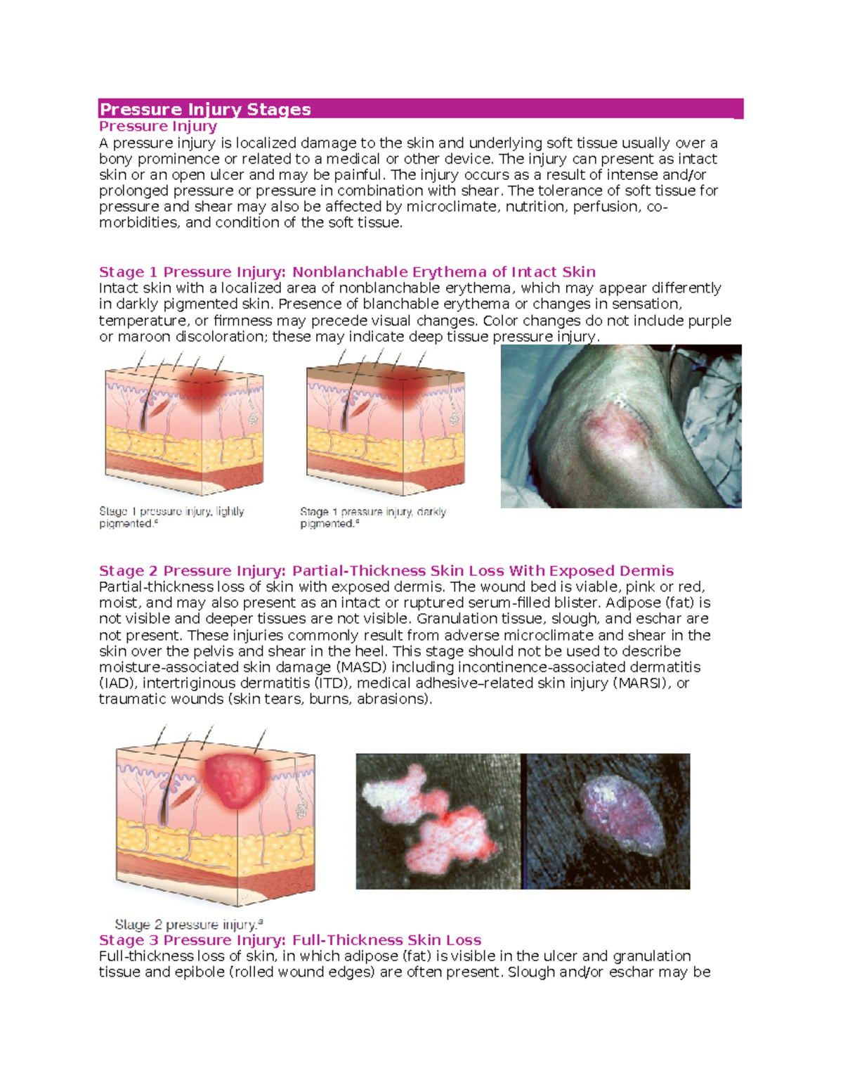Pressure Injury Stages: Understanding Classification and Care - Studocu