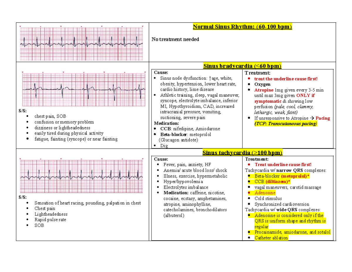 EKG Practice: Understanding Sinus Rhythm and Arrhythmias - Studocu