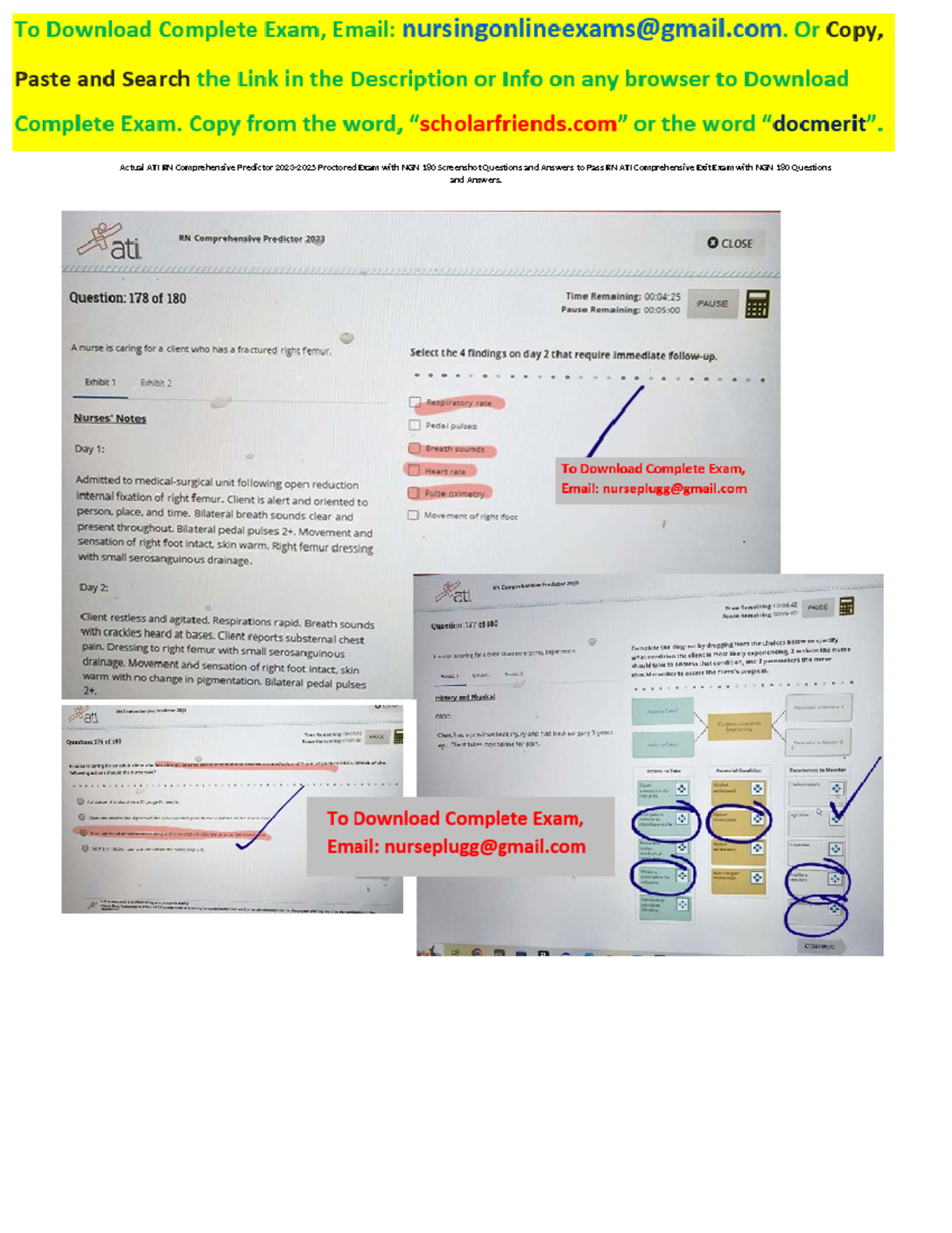 Score High on ATI RN Comprehensive Predictor 2023-2025 Exam with NGN ...