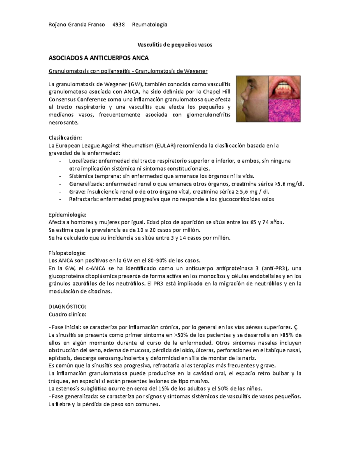 Rojano Granda Franco 4938 Reumatología - Vasculitis de Pequeños Vasos ...