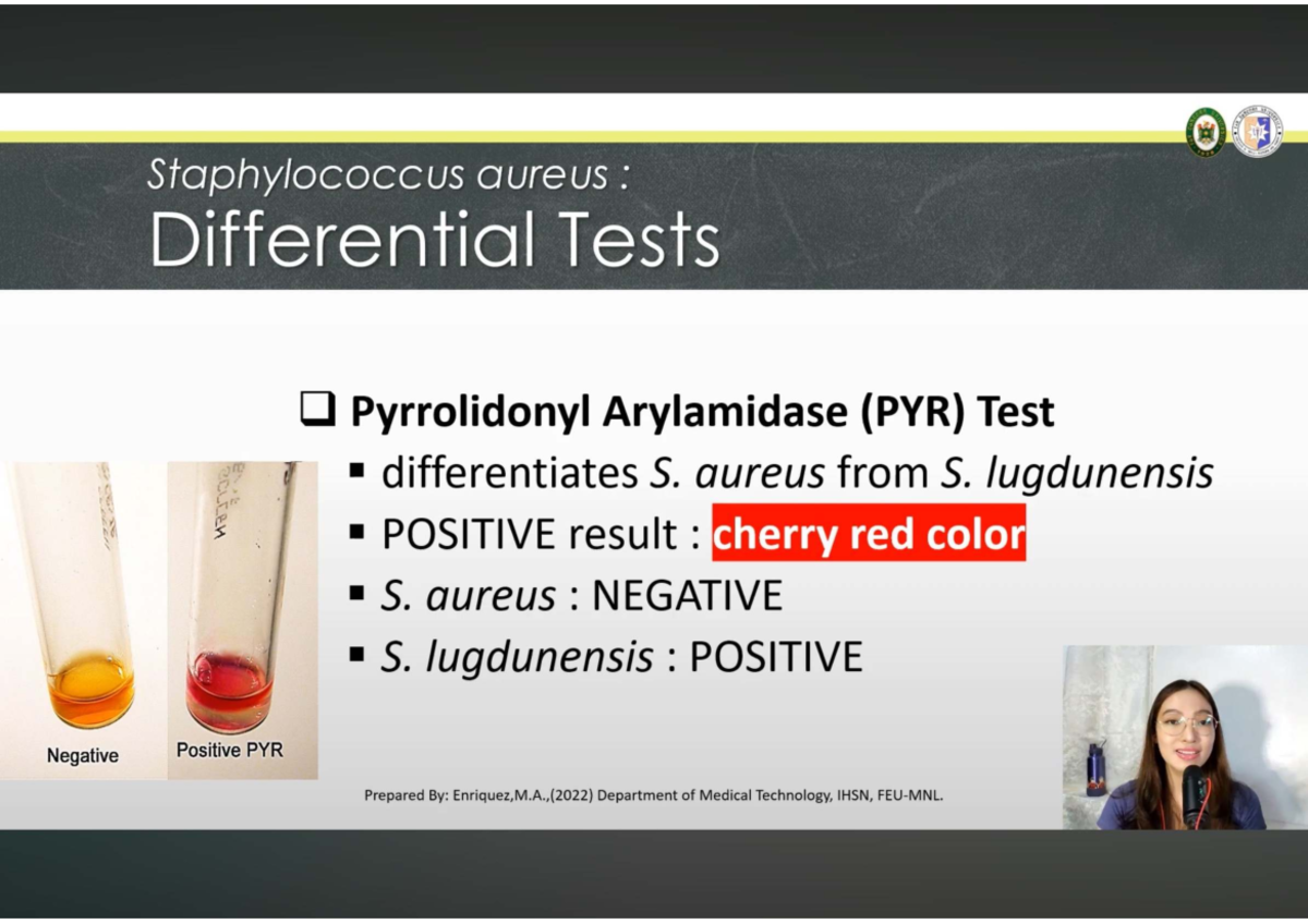 TASCORD Aerobic Bacilli: Differential Tests and Characteristics - Studocu