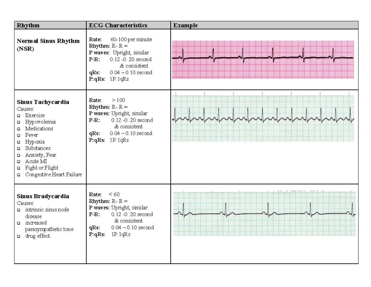 EKG Flash Chart - Published by: Department of Educational Development ...