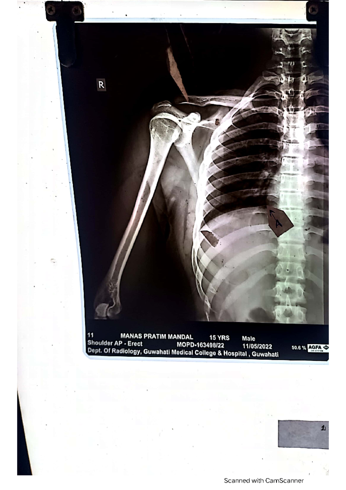 PCT 2 (2nd Phase) - Radiology Shoulder and Chest Analysis Notes - Studocu