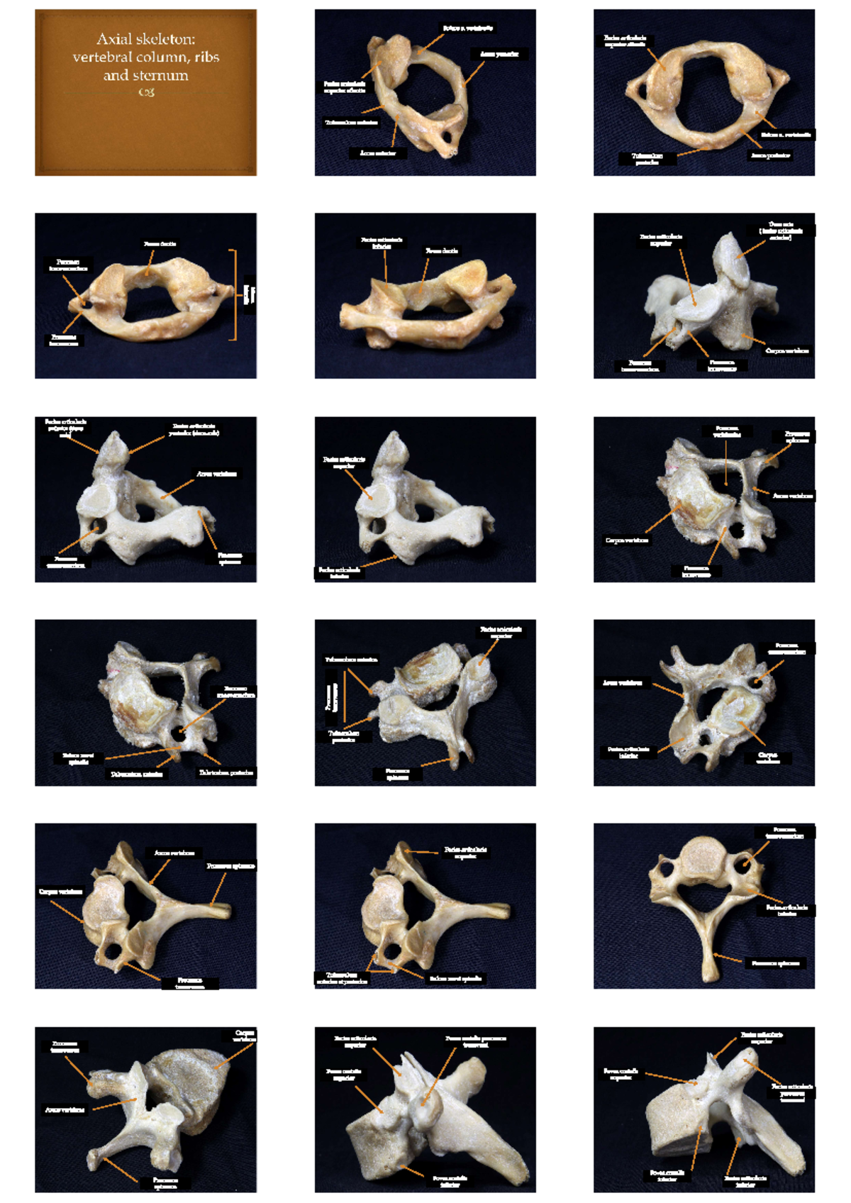 Anatomy 101 - Comprehensive Lecture Notes on Axial Skeleton and Beyond ...