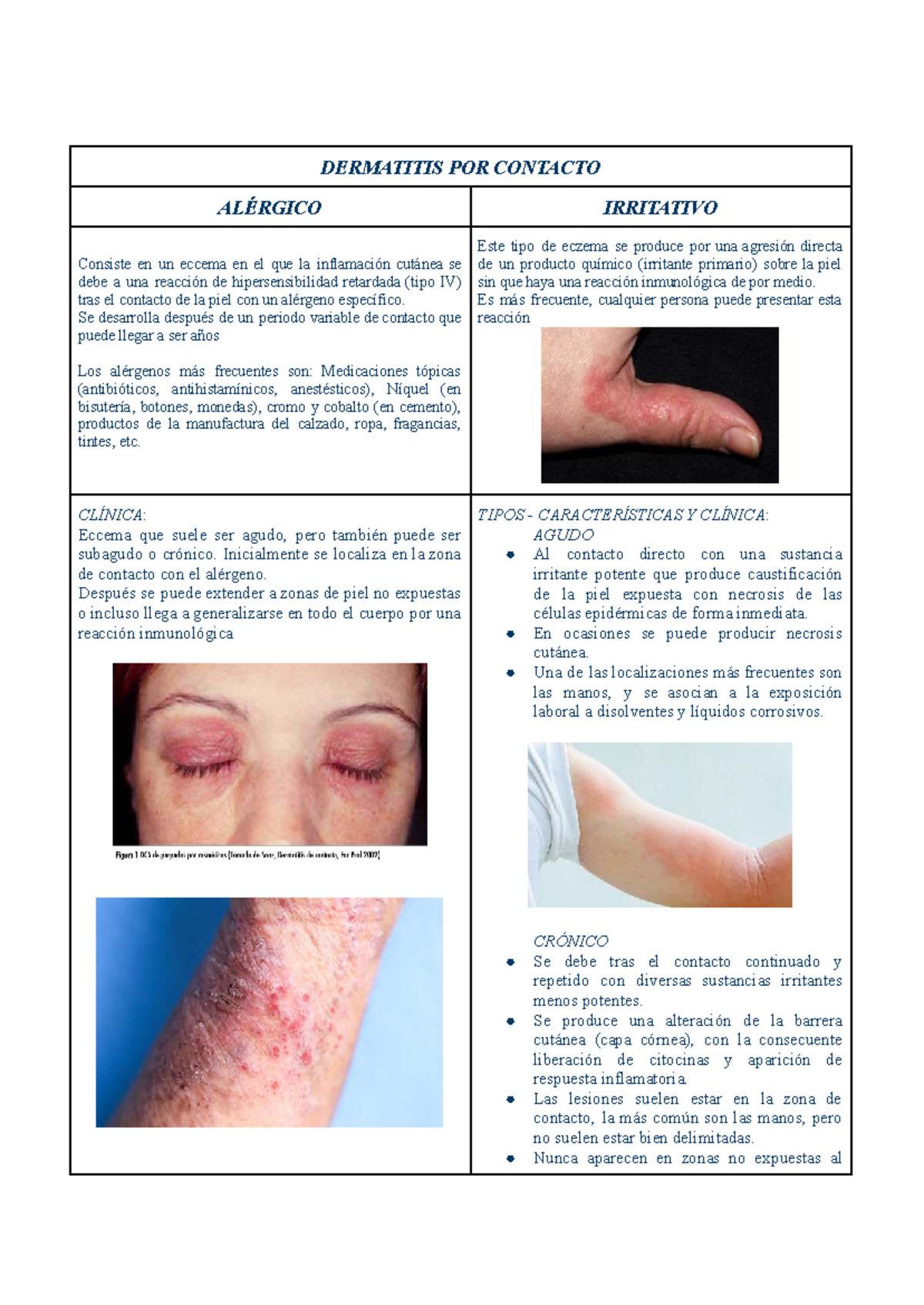 DERMATOLOGÍA: DERMATITIS POR CONTACTO ALÉRGICO Y IRRITATIVO - Studocu