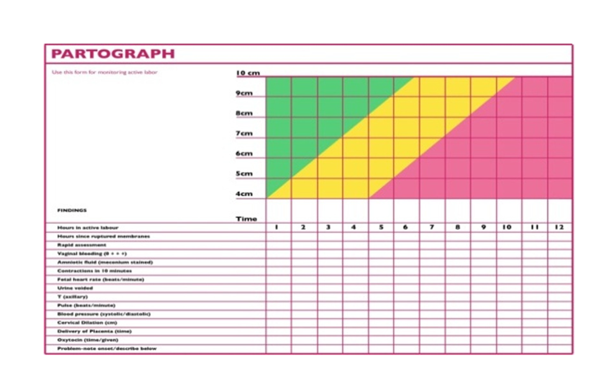 Partograph-form - form - Foundation Of Nursing - PARTOGRAPH Use this ...