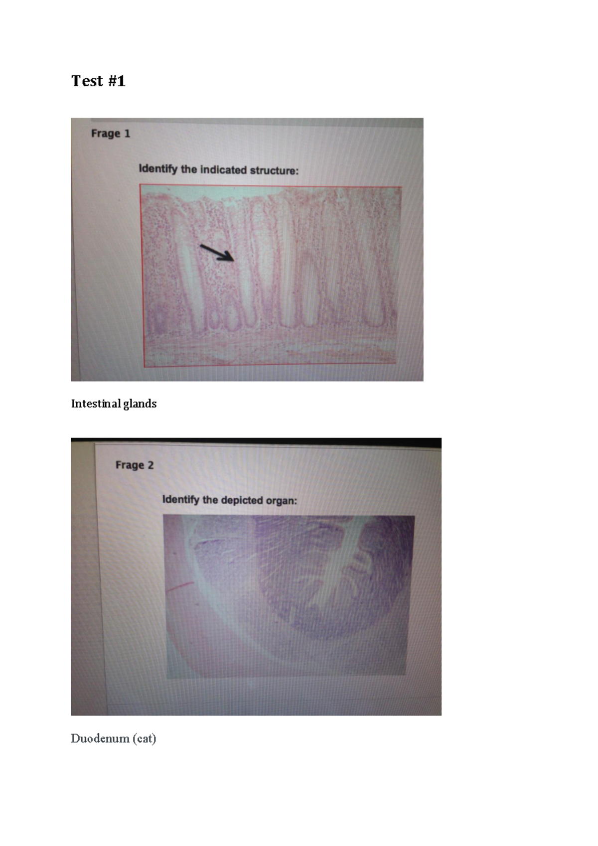 Anatomy Splancho Test 3: Key Concepts & Structures Overview - Studocu