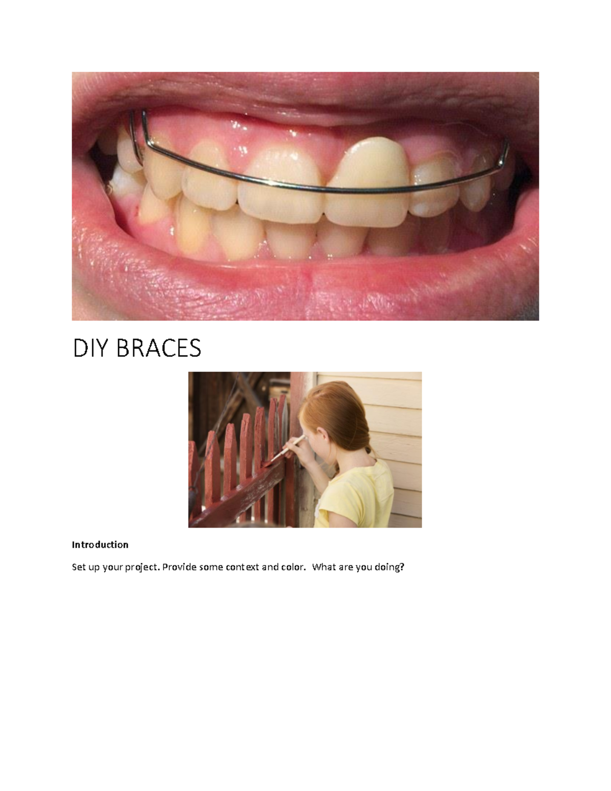 DIY Braces - DIY BRACES Introduction Set up your project. Provide some ...
