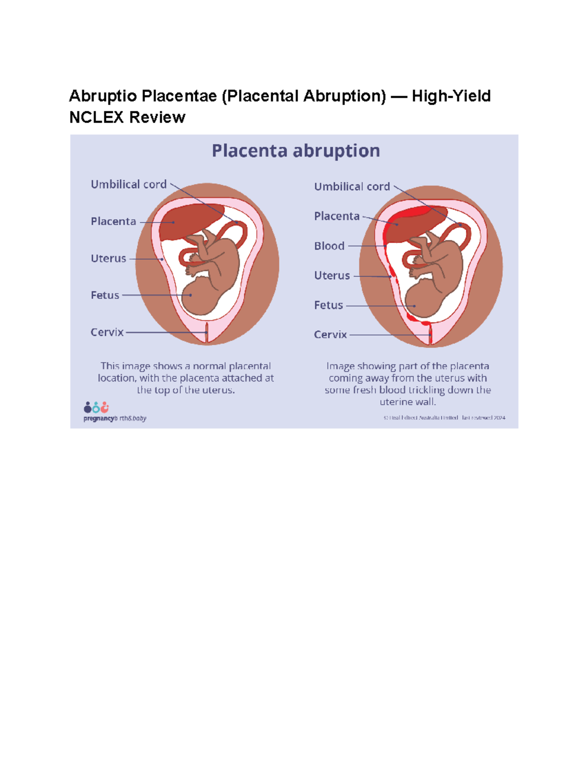 High Yield NCLEX Review: Abruptio Placentae (Placental Abruption) - Studocu