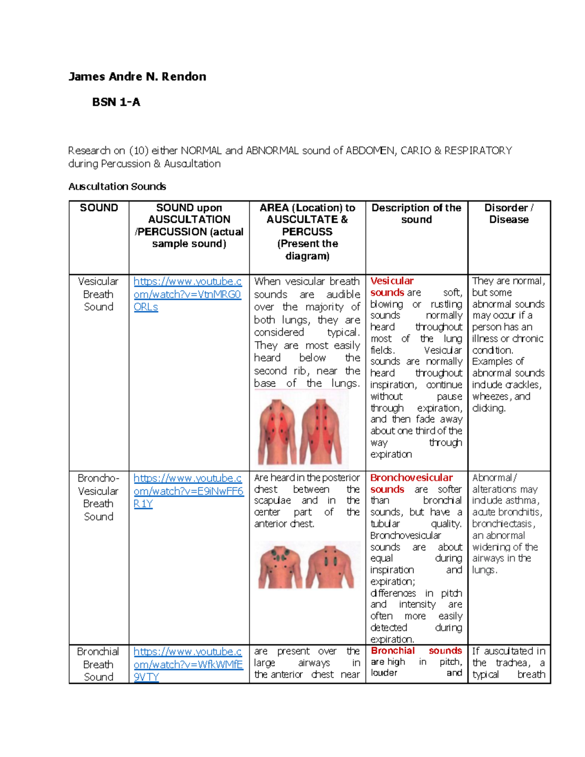 BSN 1A Rendon, James Research Case Analysis - James Andre N. Rendon BSN ...