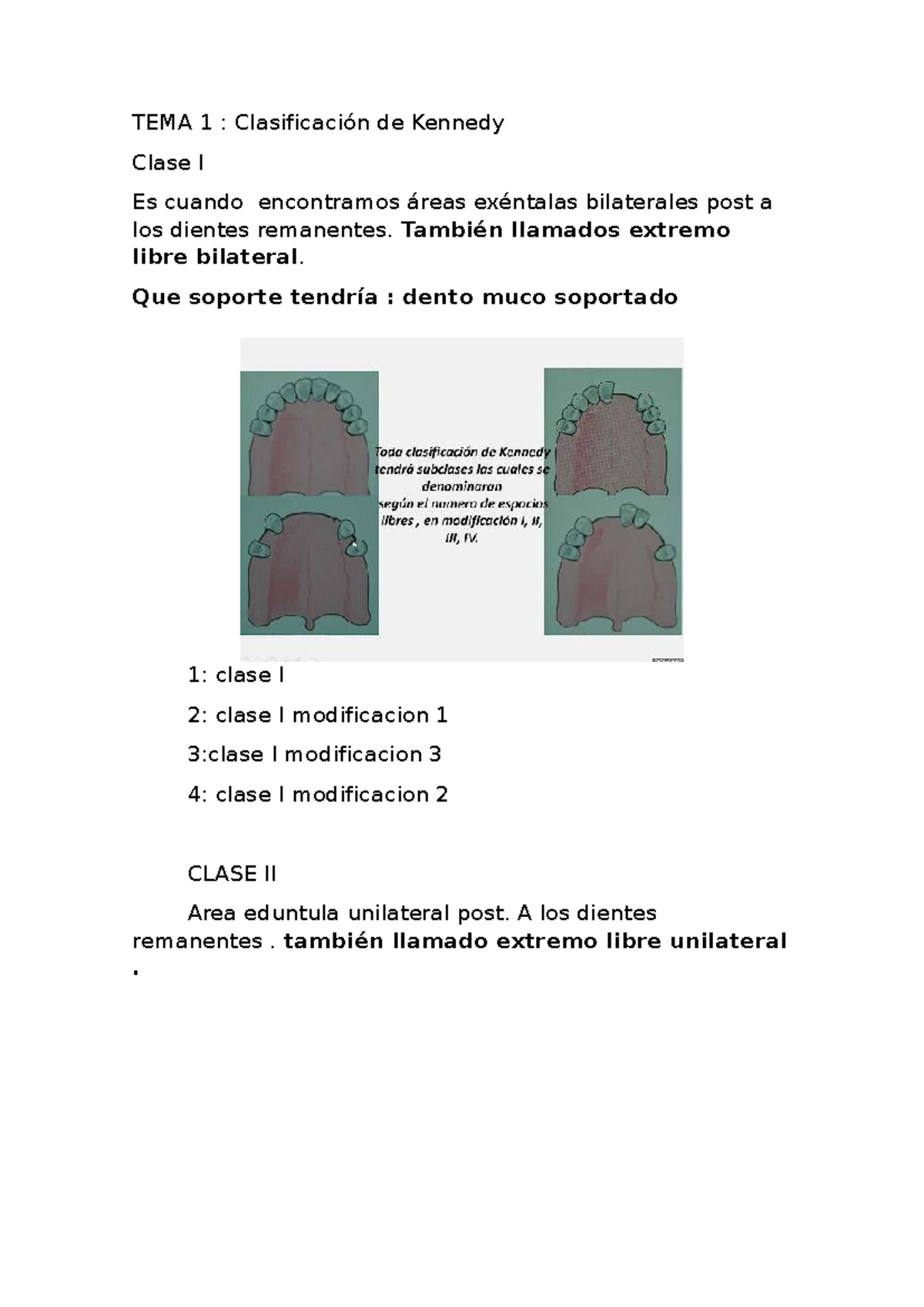 TEMA 1 y 2: Clasificación de Kennedy y Línea de Fulcrum en PPR - Studocu
