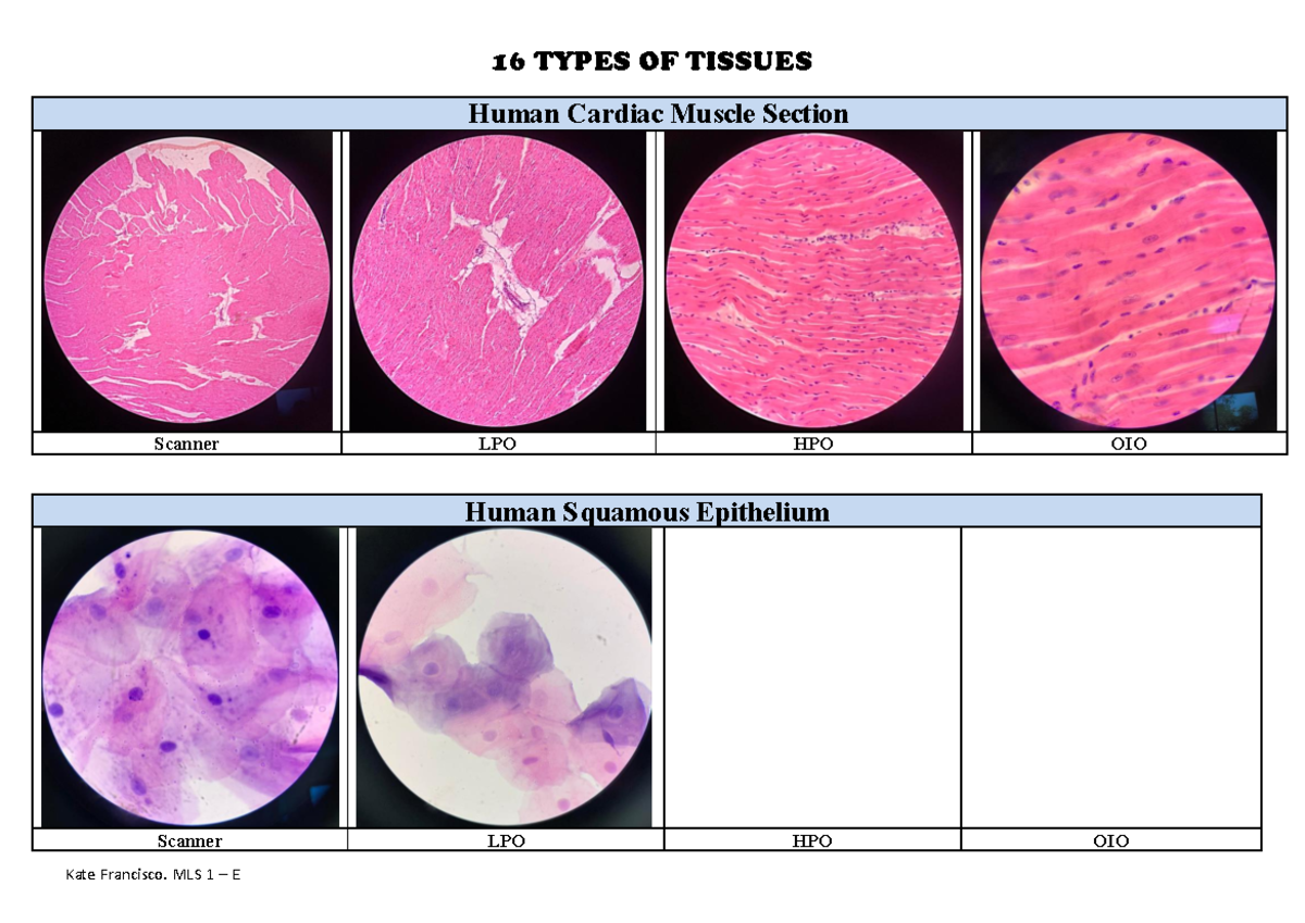 16 Types OF Tissues - lesson - 16 TYPES OF TISSUES Human Cardiac Muscle ...